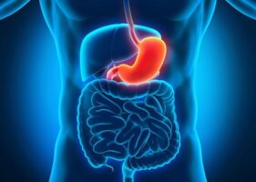 Maagbloeding: Nursing Challenge - Nursing.nl