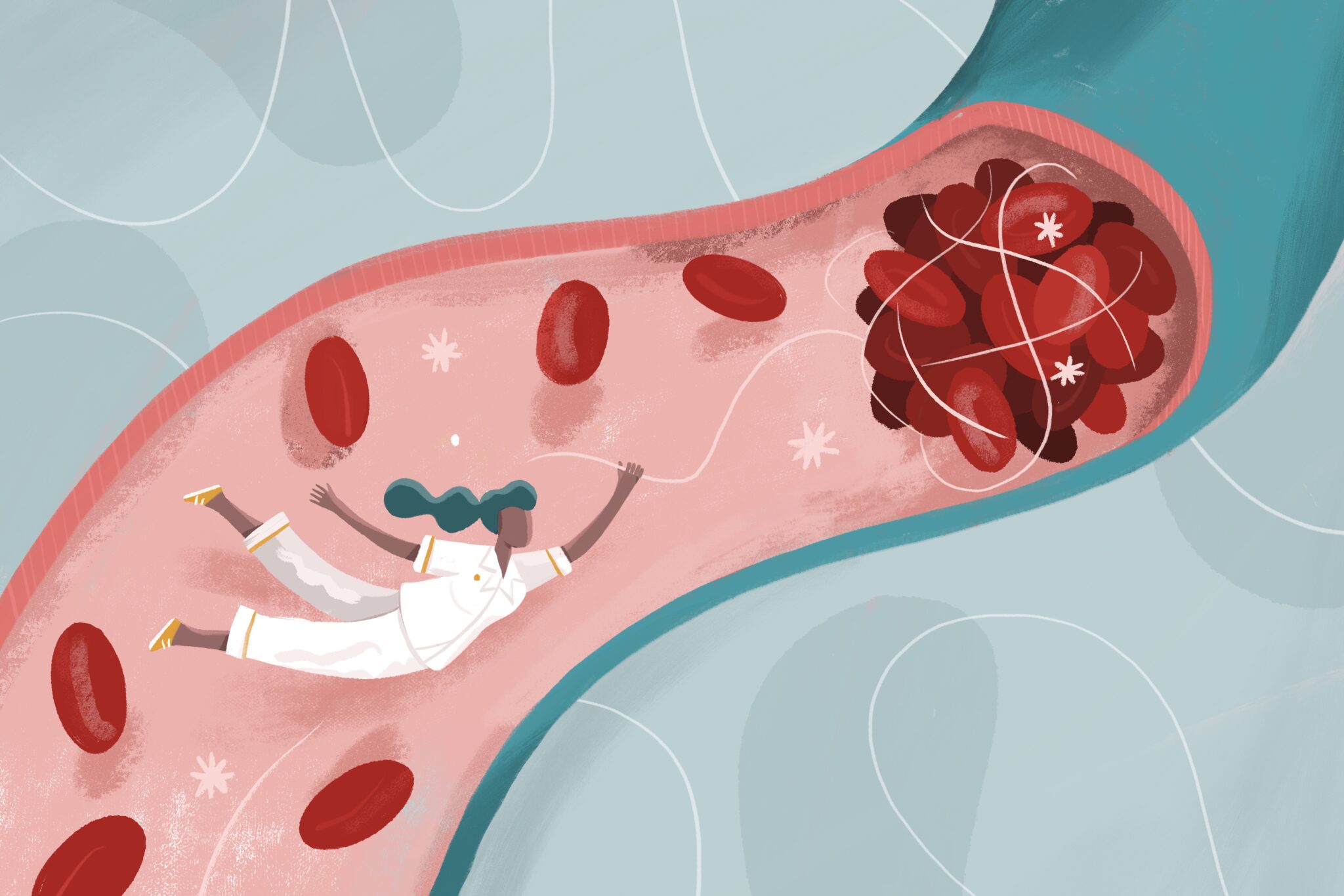 Nursing Challenge Trombose | Hemostase, stolling en wat er misgaat bij ...
