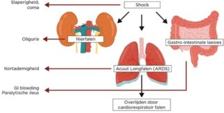 Nursing Challenge: klinisch redeneren bij hypovolemische shock - Nursing.nl | Nursing voor ...