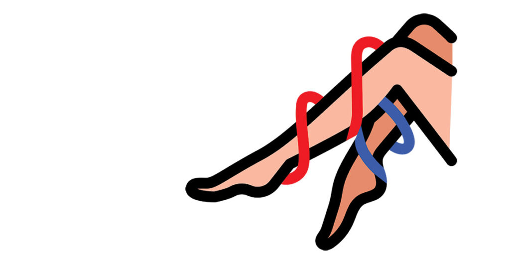 Arterieel of veneus ulcus: dit zijn de 6 belangrijkste verschillen ...