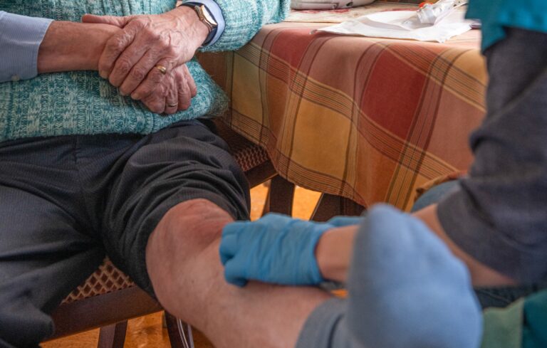 Do's en dont's bij smetten: voorkomen en behandelen